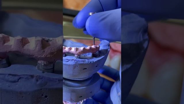 Как выглядит балка Постоянного Керамокомпозитного Протеза All-On-4. Неватекс отзывы