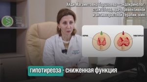 Лечение гипотиреоза