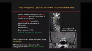 Week 1: Sunday 12, July 2020 \ Head & Neck \ Imaging of Ophthalmology Emergency