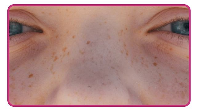 Vocabulary presentation 01-01_ Freckles