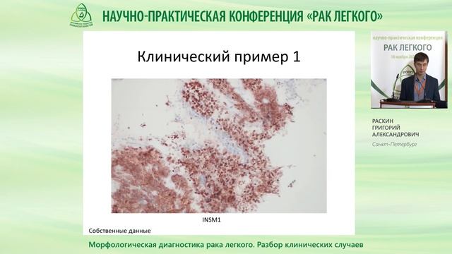 Морфологическая диагностика рака легкого  Опыт МИБС