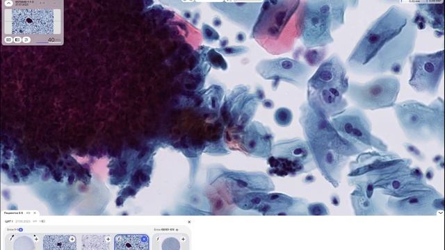 Обзор возможностей сканирующих систем для применения в цитологической практике