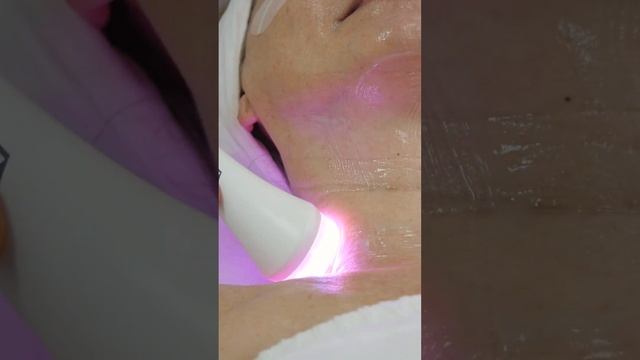 Rhea - новая косметика и уникальная процедура омоложения