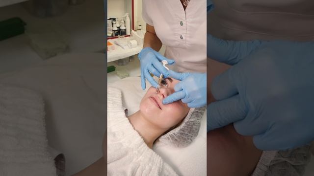 Увеличение губ в медцентре ВитаСПА