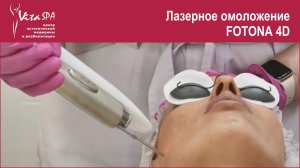Fotona 4D - лазерное омоложение