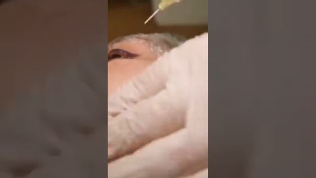 Инъекционные процедуры в ВитаСПА