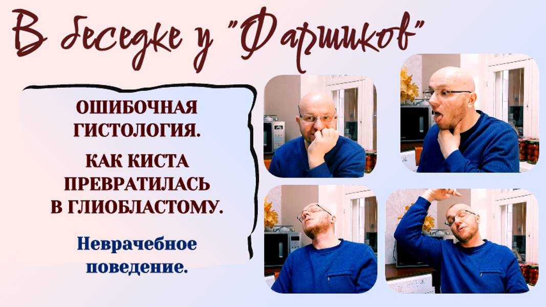 РАК МОЗГА. Киста превратилась в глиобластому. Ошибочная гистология. Неврачебное поведение.