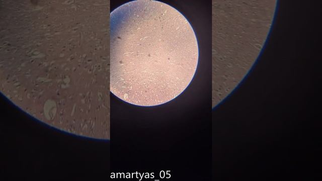Cerebrum | Histology Slides | Karwar institute of medical sciences