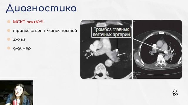 Пульмонология | Острое легочное сердце. ТЭЛА - тромбоэмболия легочной артерии