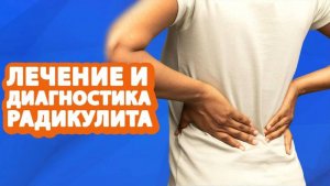 Лечение радикулита в домашних условиях