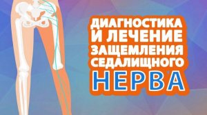 Диагностика и лечение защемления седалищного нерва