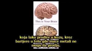 Nanočestice aluminija iz chemtrailsa oštećuju ljudski mozak!