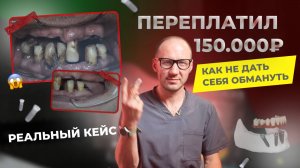 Скрытые платежи в стоматологии: необходимость или обман?