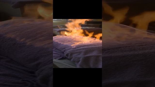 Подожгли пациента Нижегородский Костоправ 89870878785 @kostoprav52