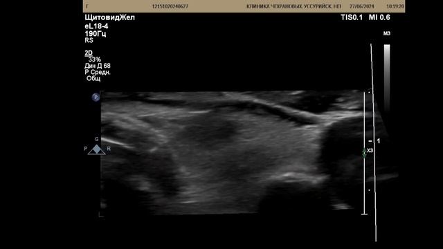 Огромный узел TIRASDS 3