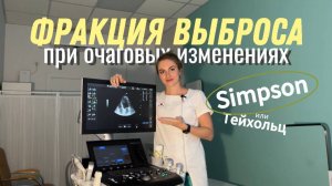Измерение ФРАКЦИИ ВЫБРОСА при очаговых изменениях на ЭхоКГ. Симпсон или Тейхольц?