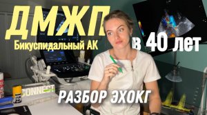 А вы ТАКОЕ ВИДЕЛИ? ДМЖП у 40 летнего мужчины! Бикуспидальный АК. Эхокардиография