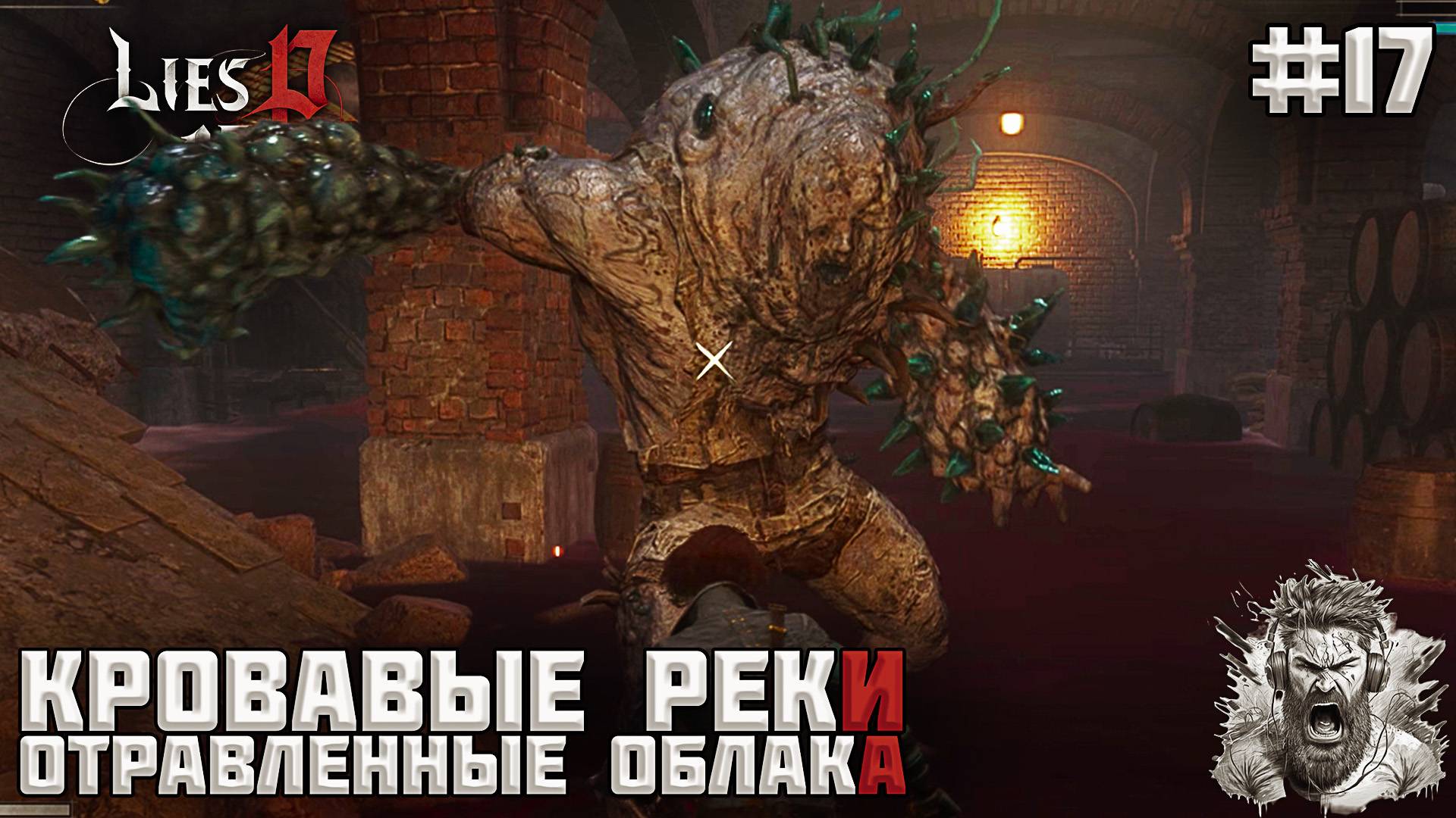 АРКАДА ЛОРЕНЦИНИ ◢ Lies of P #17