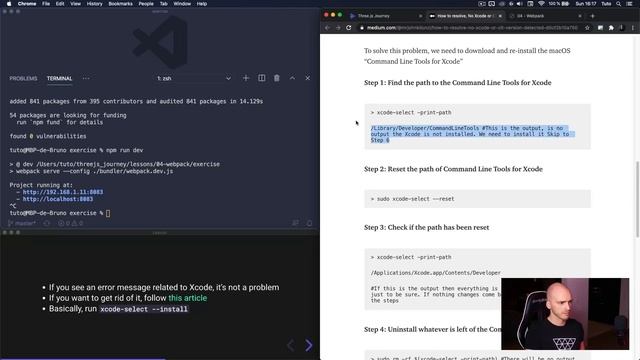 4-04-webpack