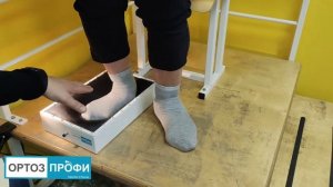 Изготовление индивидуальных стелек при сложной вальгусной деформации стоп