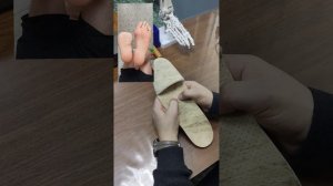 Стелька при ампутации части стопы