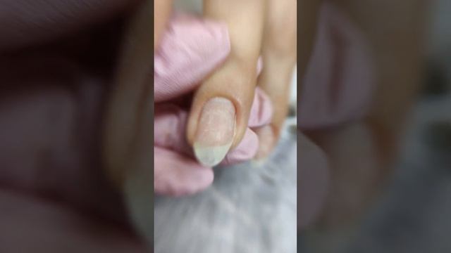 Попытка сделать острую трапецию