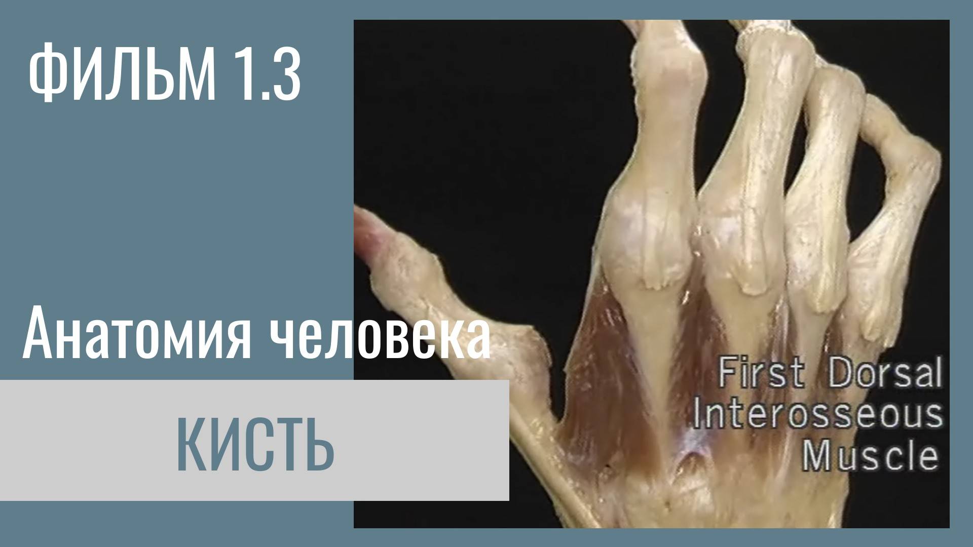КИСТЬ. Анатомия человека. Видеоатлас Acland. Фильм 1.3