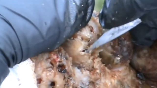 Jiggers Torn Off l One Of The Scariest Feet In Africa v4 - смотреть ...