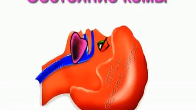 4. Первая помощь при состоянии комы