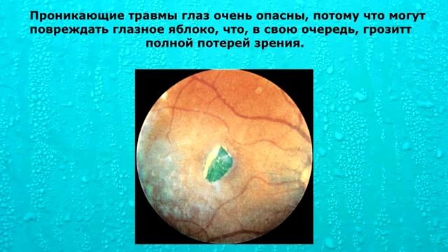 10. Травмы глаз