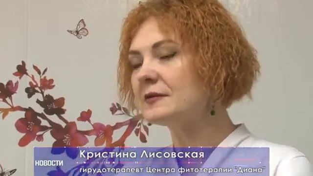 Гирудотерапия в «Диане»