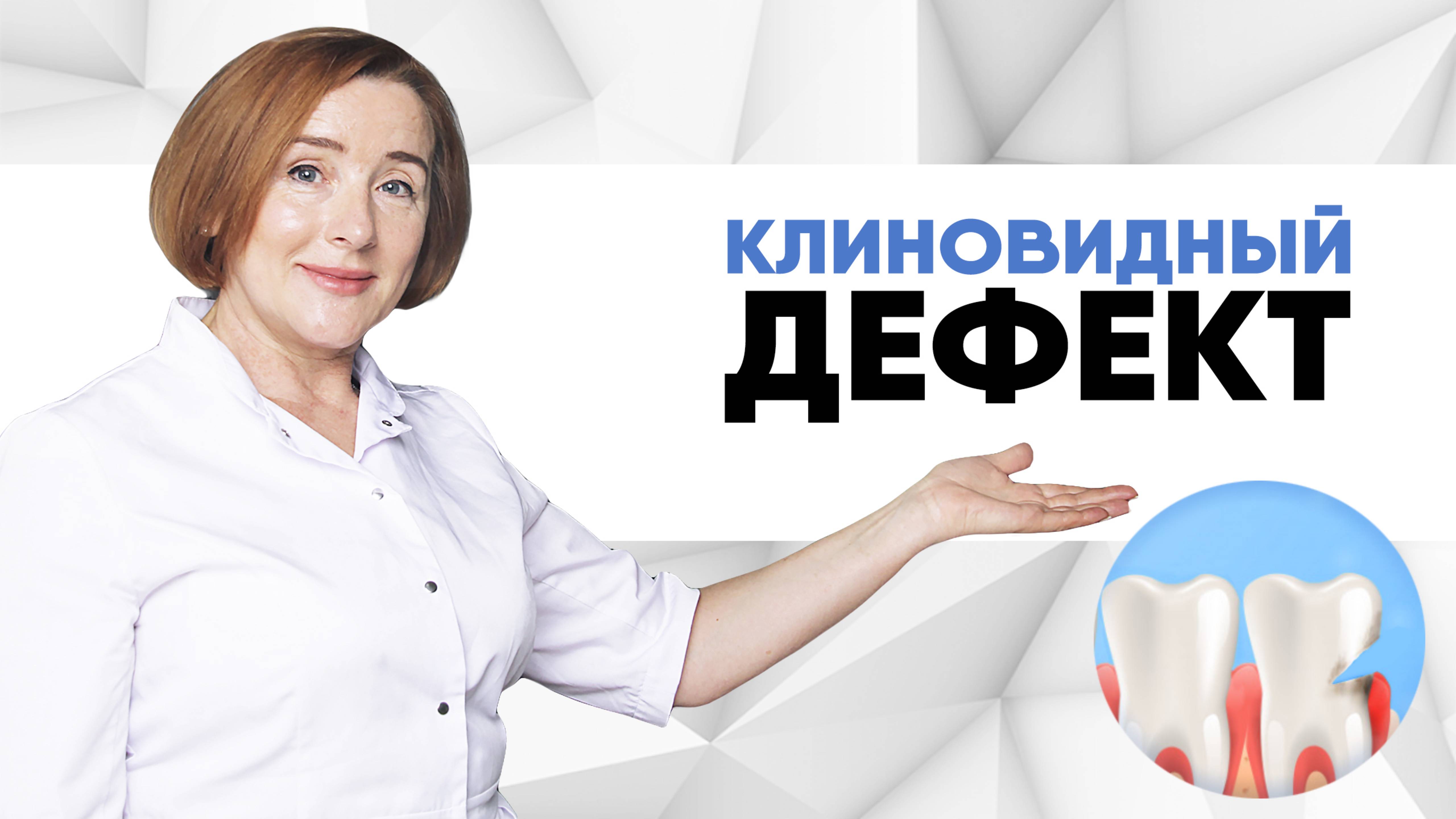 Клиновидный дефект. Что, если не лечить клиновидный дефект? Пришеечный кариес, что делать?