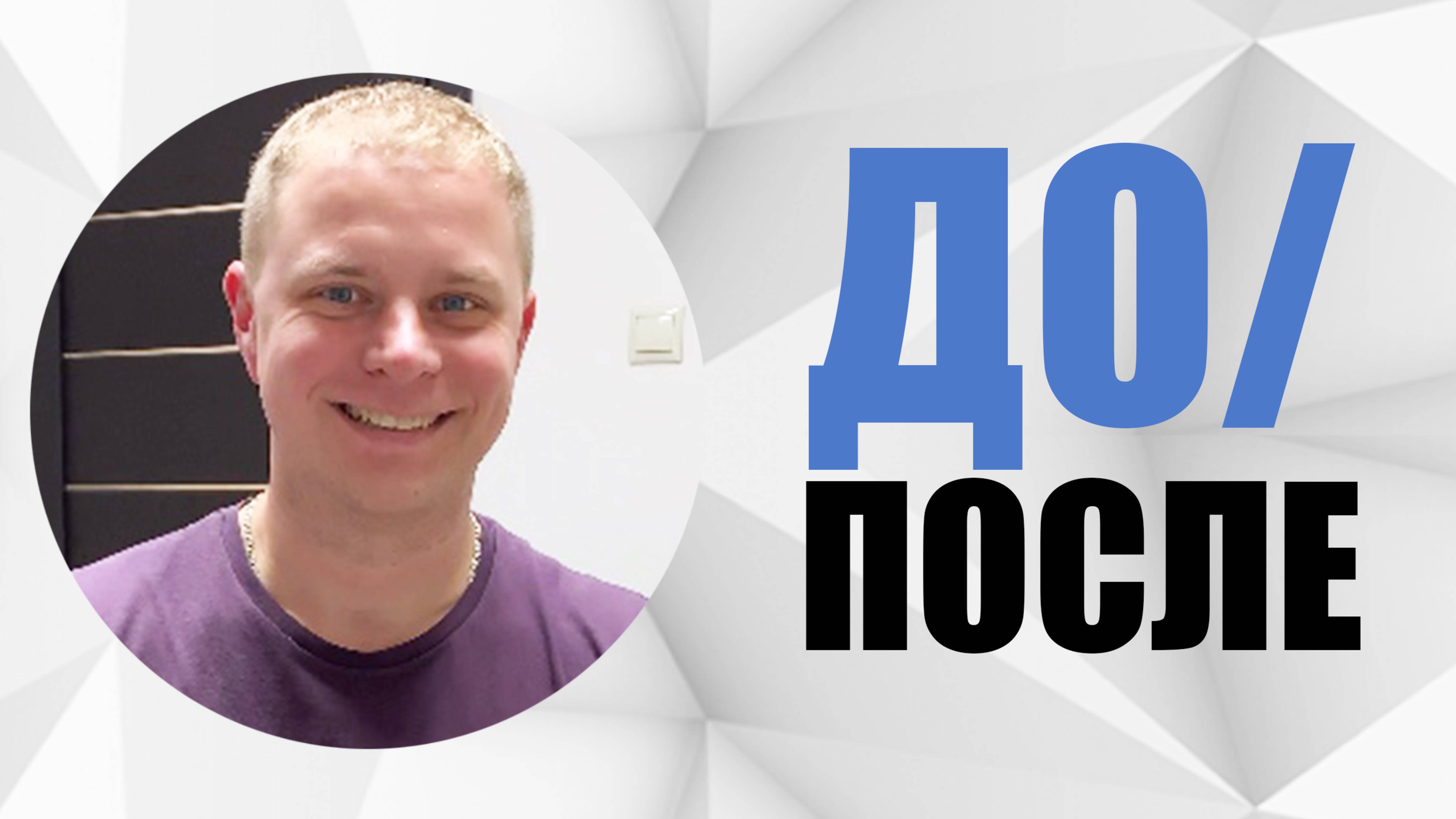 #2 Случай. Клинический случай до лечения и после его завершения.