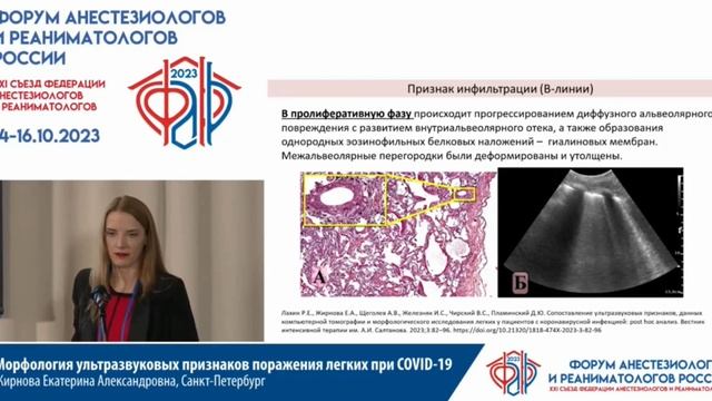 Морфология УЗИ призн при Ковид19 Жирнова Е.А.Съезд ФАРР 2023