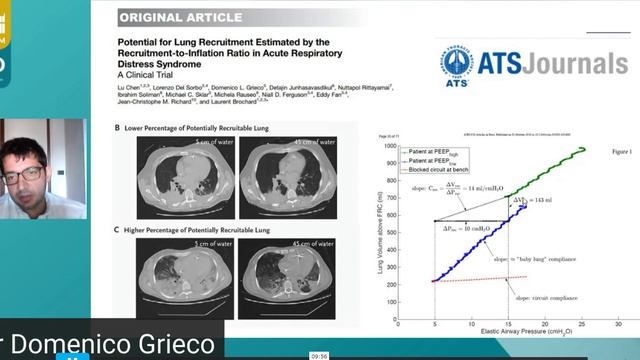 The potential role of EELV (FRC) measurement (isicem ARDS 2021)