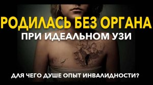 Родилась без органа | Медицина бессильна - врачи не помогли | Зачем душе опыт инвалидности?