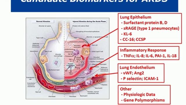 UTILITY OF BIOMARKERS TO PREDICT ARDS