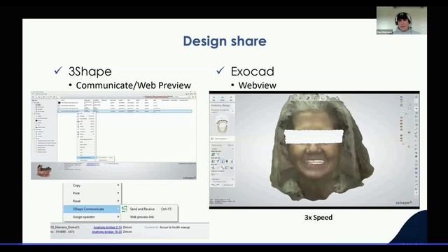 Exocad против 3Shape: почему оба не могут победить?