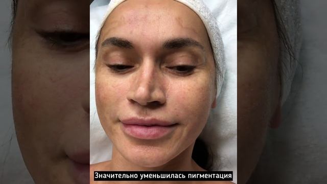 Альгинатная маска для восстановления цвета лица с экстрактом толокнянки и витамином С