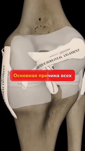 Физиотерапия не лечит колени!