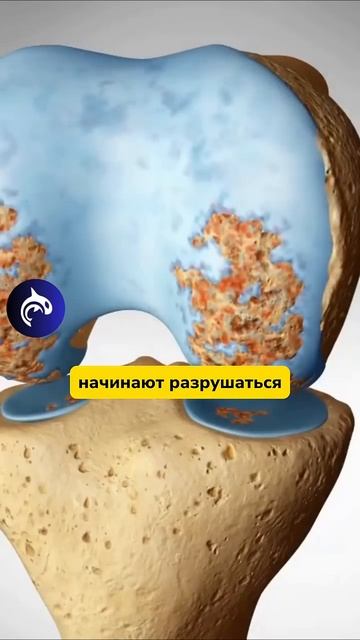 Кто еще верит, что операция - это решение