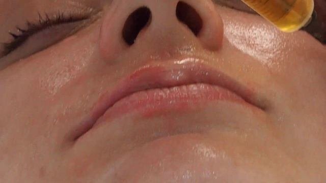 Мезопилинг фракционно и мануально (Часть 3)