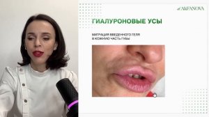 детальный разбор осложнений после КП губ