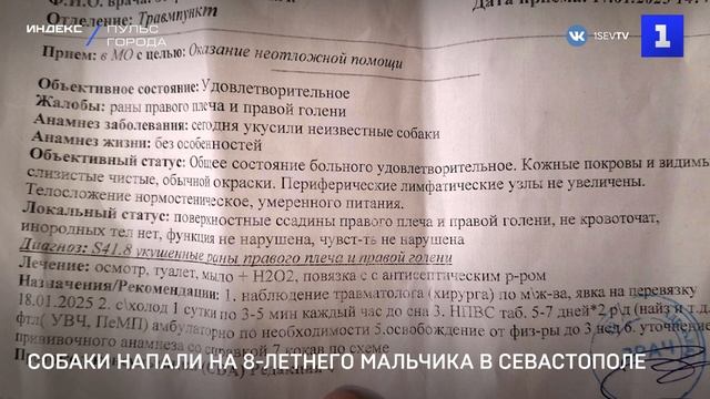 Собаки напали на 8-летнего мальчика в Севастополе