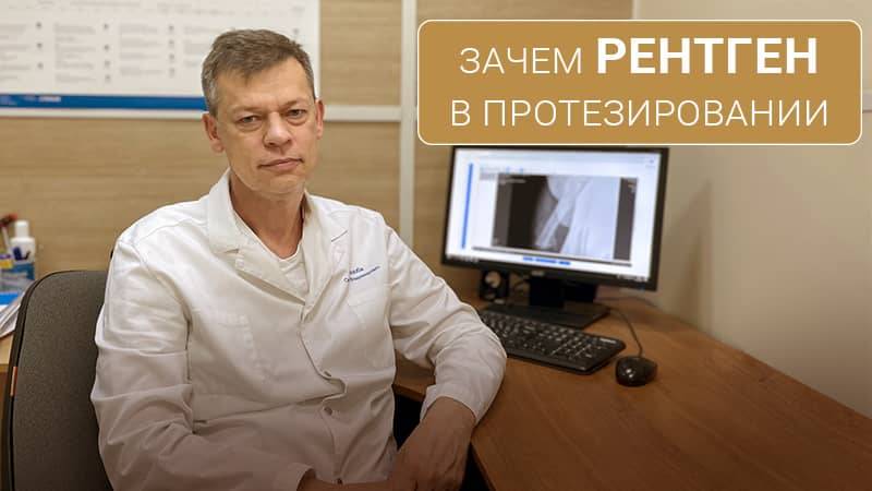 Рентген – помощник в протезировании!