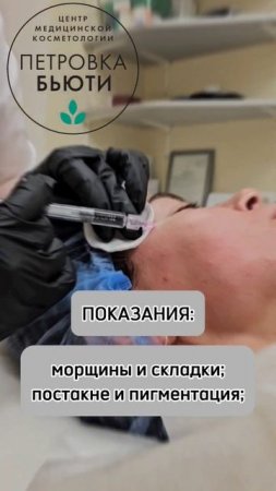 Биоревитализация Нуклеоформ косметология #shorts #косметолог #косметология #врач #биоревитализация
