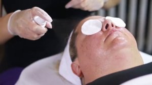 Ретиноловый пилинг TIZO Peel
