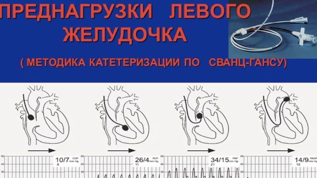 ОИМ Кардиогенный шок часть 1 Кошкина Е. В.