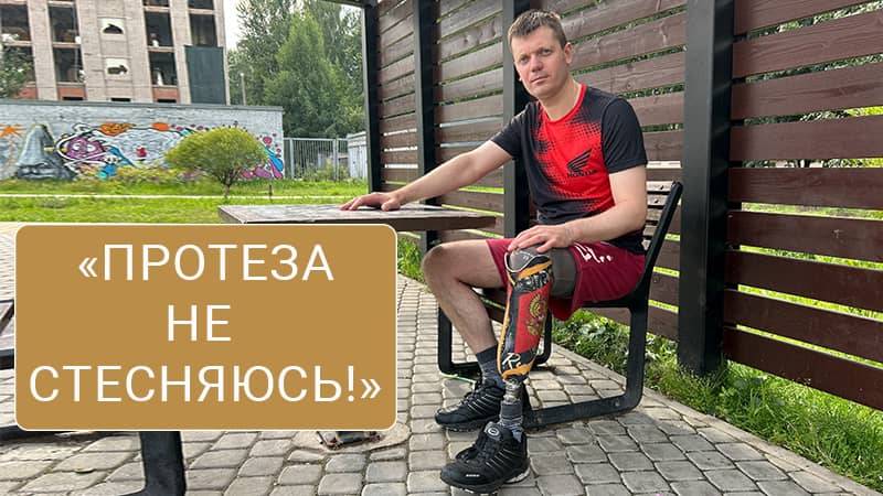 «Протеза не стесняюсь!»
