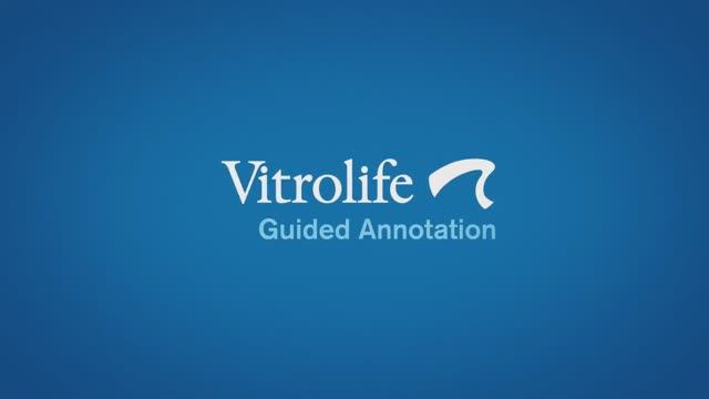 Интеллектуальная обработка данных с Guided Annotation